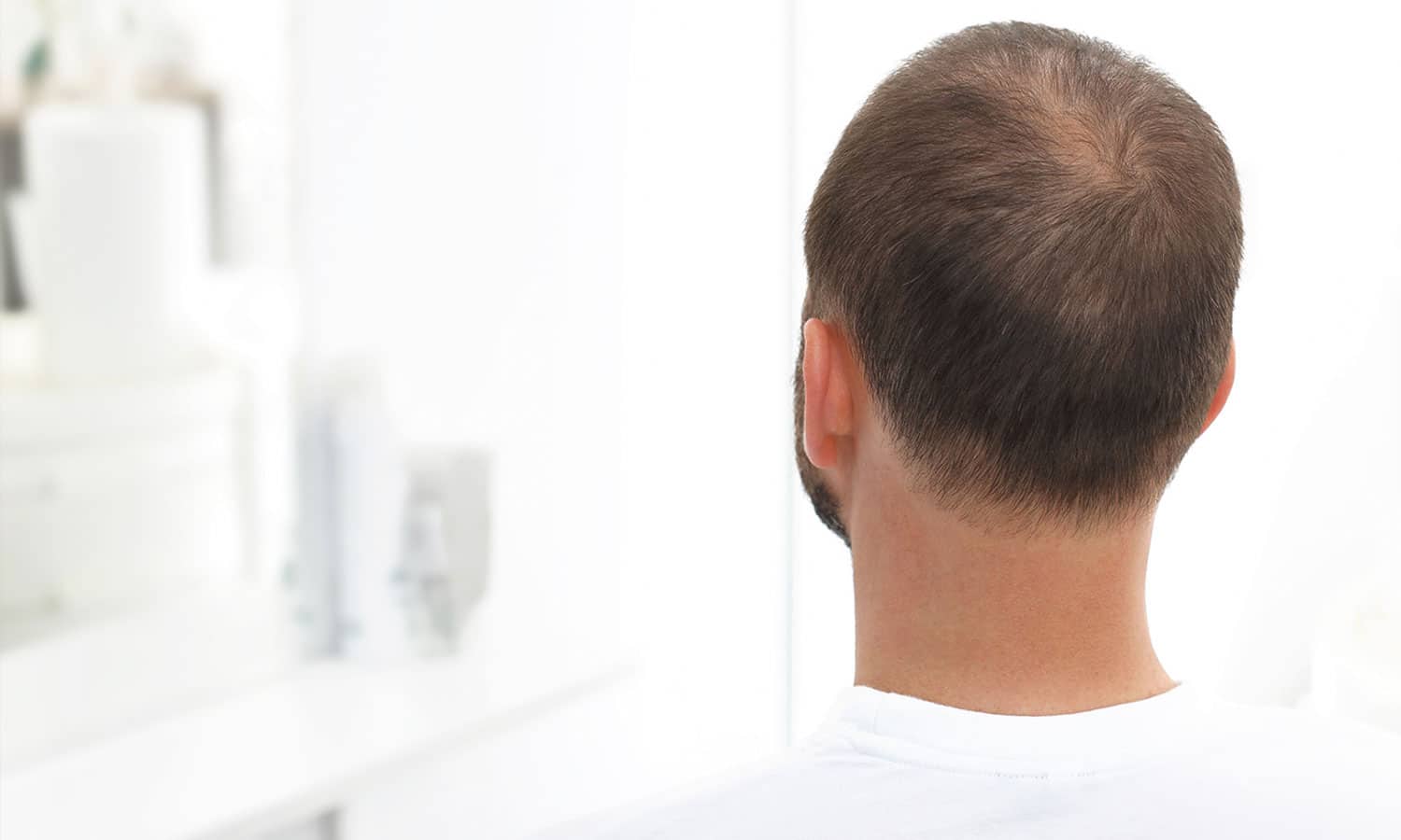 Greffe de Cheveux | ALFA HAIR TRANSPLANT